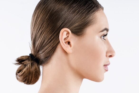 Comparatif dent sur pivot vs implant : avantages et différences - Medic Com